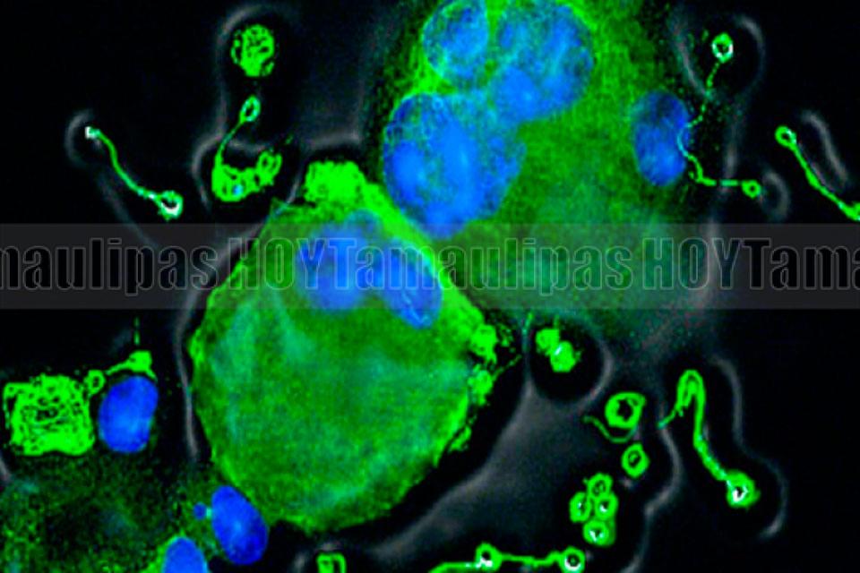 Hoy Tamaulipas - Inmuno-Oncologia la nueva terapia contra el cancer ...