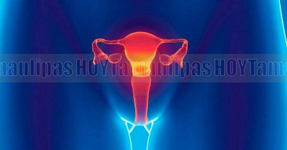 Hoy Tamaulipas - Programa MICAELA brinda atencion integral a mujeres ...