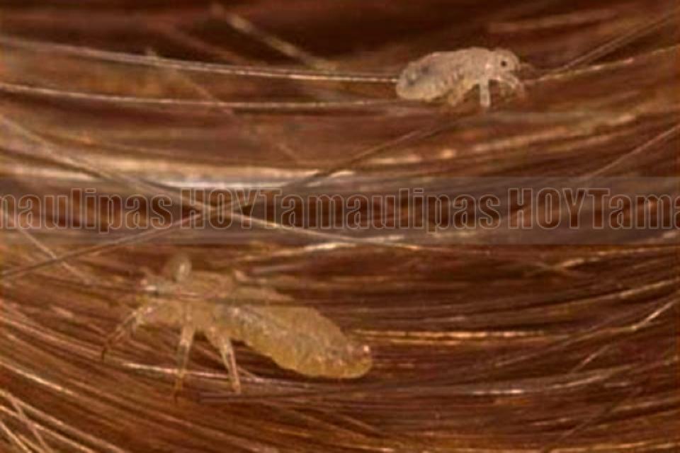 Hoy Tamaulipas - Pulgas y piojos del cuerpo humano tambien propagaron ...