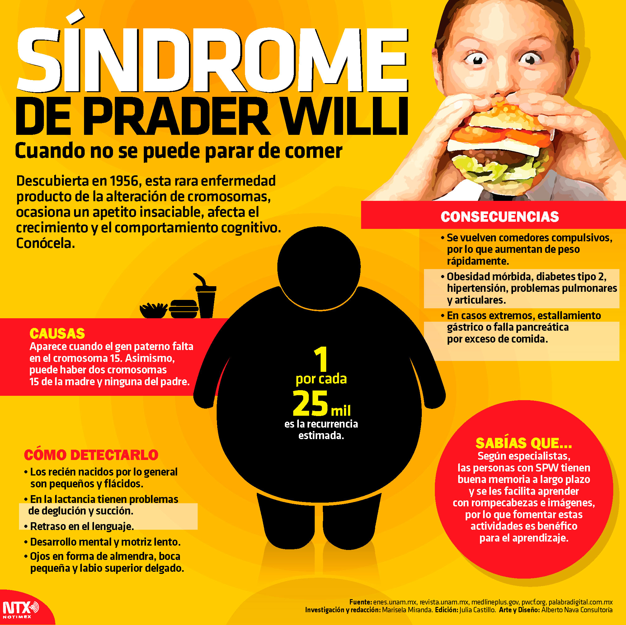 Síndrome de Prader Willi Síndrome de Prader Willi